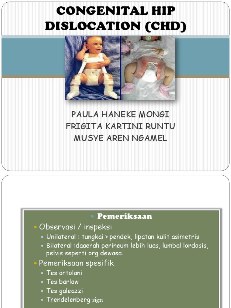 Congenital Hip Dislocation (CHD) | PDF