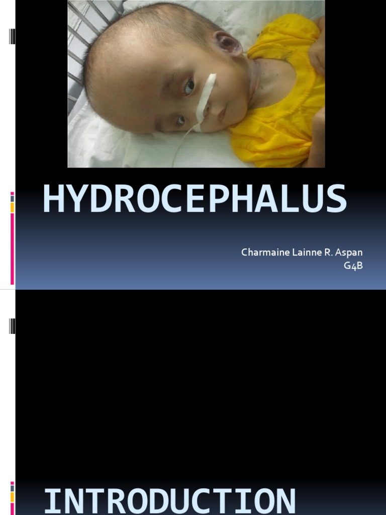 Everything You Need to Know About Hydrocephalus | PDF | Cerebrospinal ...