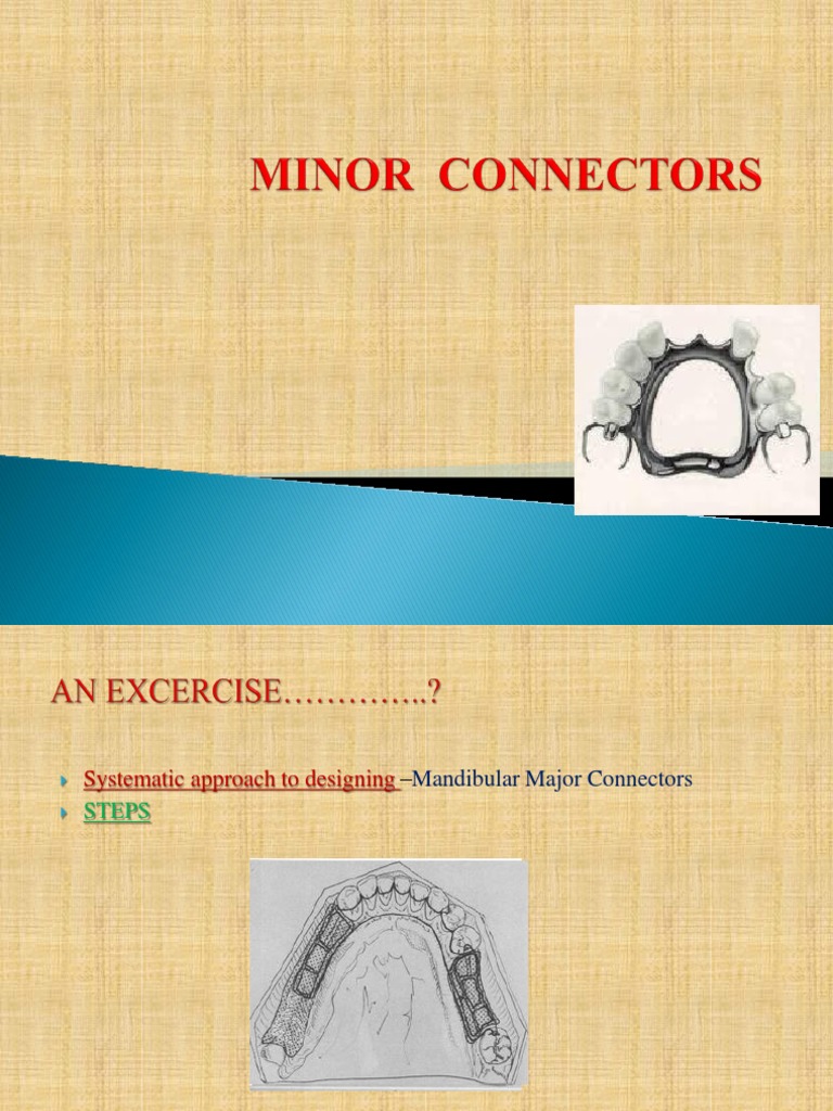 Minor Connectors | PDF | Dentures | Mouth