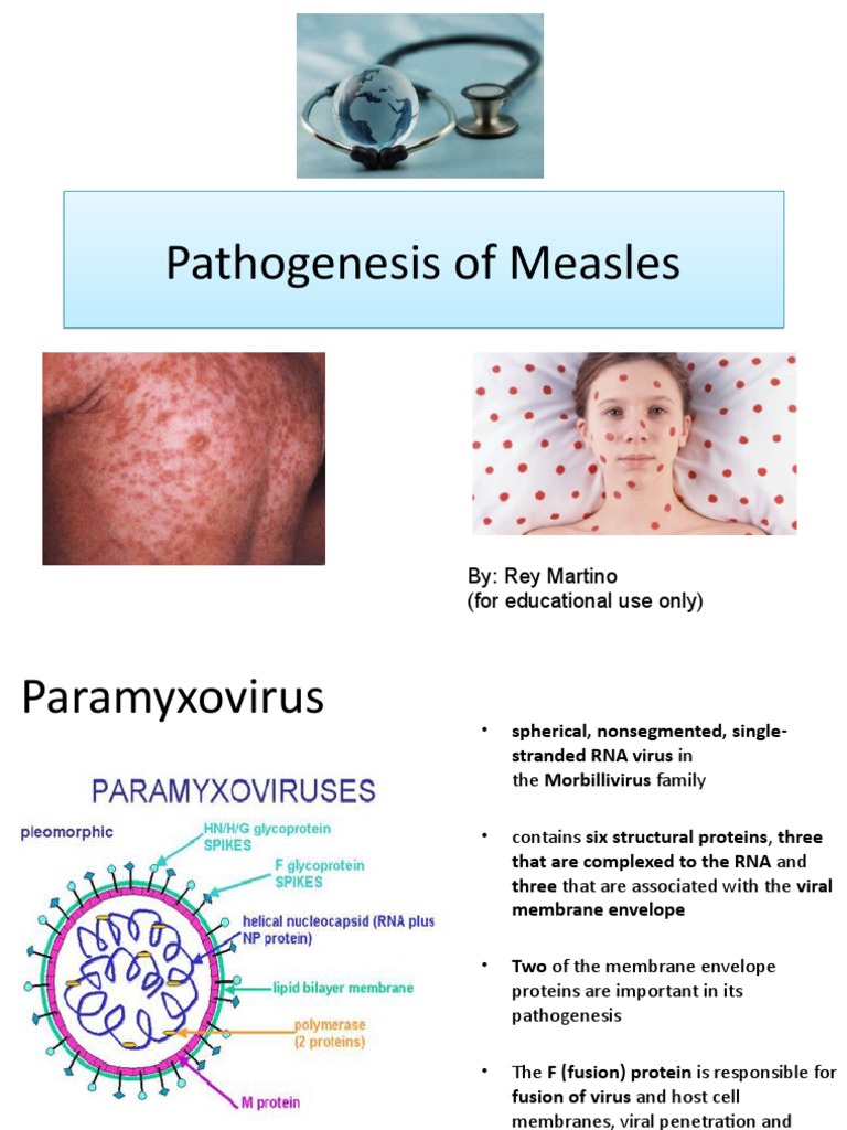 Measles Pathogenesis Overview | PDF | Virus | Immunology