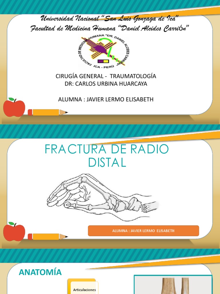 Clasificación y tratamiento de fractura de radio distal | PDF ...