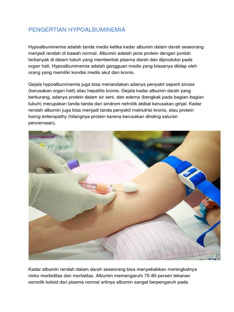 Pengertian Hypoalbuminemia | PDF | Pengembangan Diri | Kesehatan Holistik