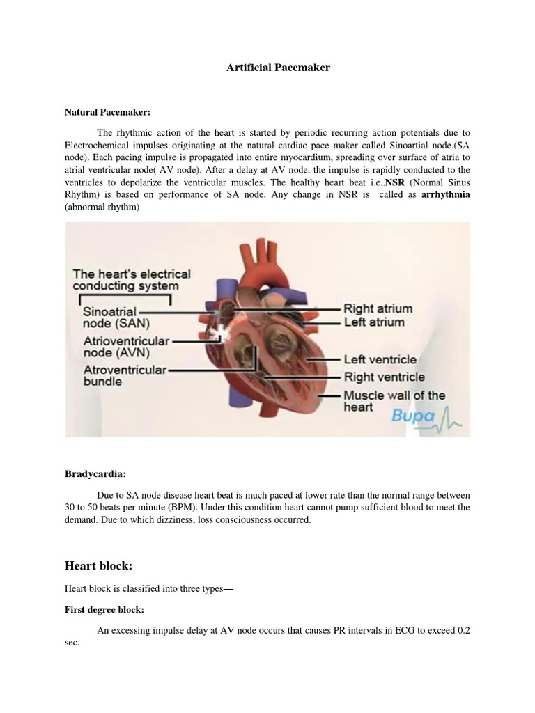 Pacemaker | PDF | Artificial Cardiac Pacemaker | Heart