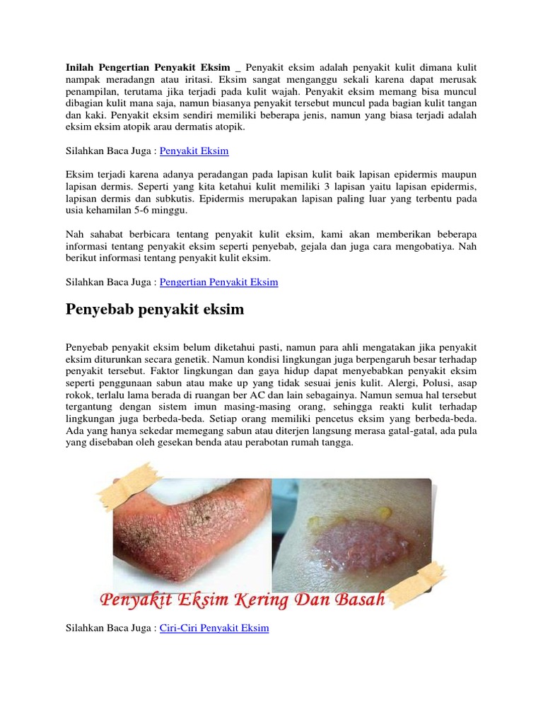 Inilah Pengertian Penyakit Eksim | PDF