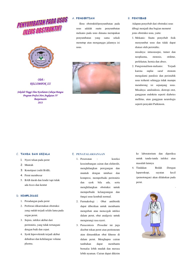 Leaflet Ileus Obstruktif | PDF