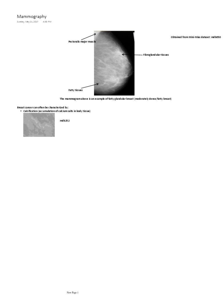 Mammogram Analysis for Radiologists | PDF