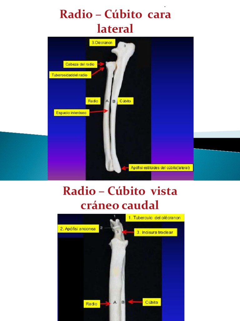Radio y Cubito | PDF