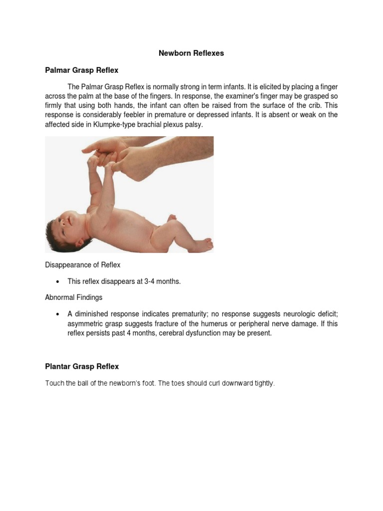 Newborn Reflexes | Download Free PDF | Anatomical Terms Of Motion | Infants