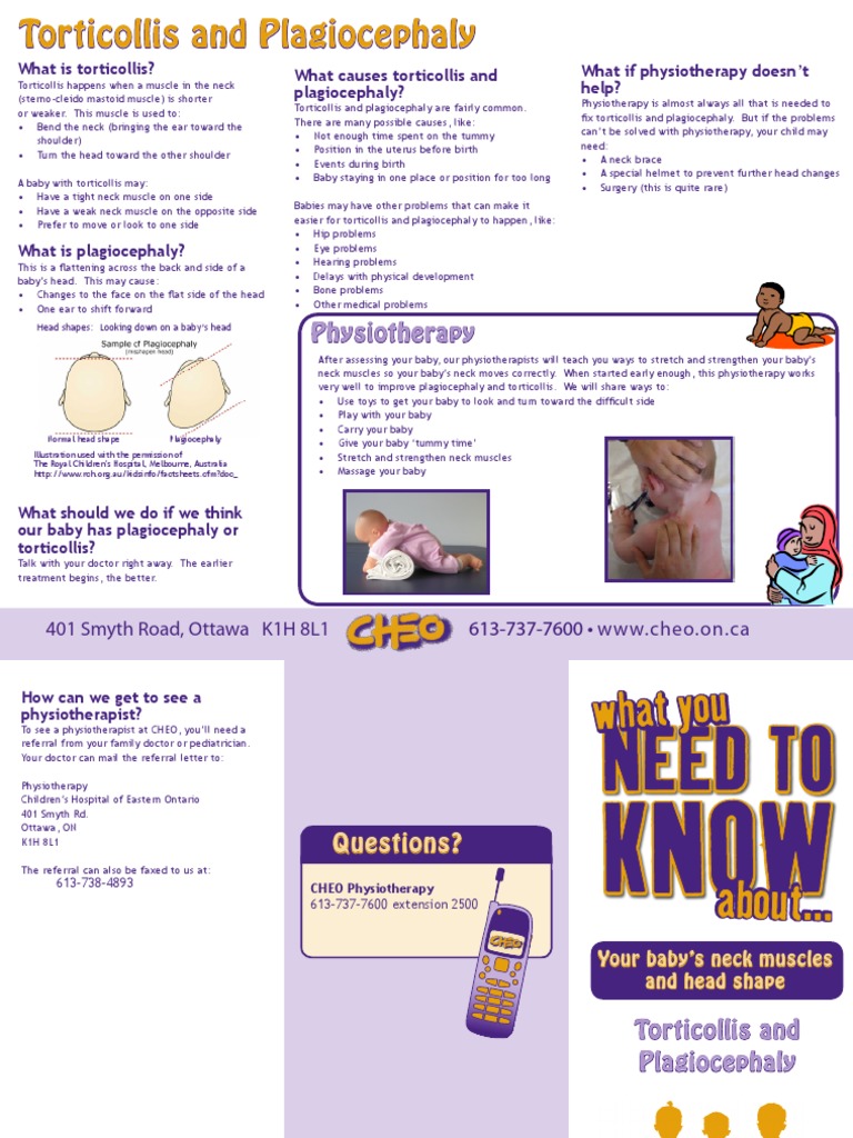 Torticollis Pdf Pdf Musculoskeletal Disorders Physical Therapy
