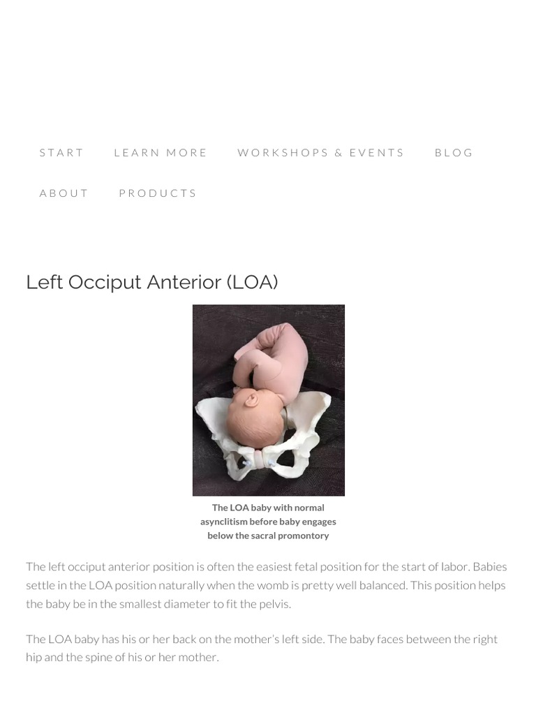 Left Occiput Anterior (LOA) | PDF | Pelvis | Musculoskeletal System