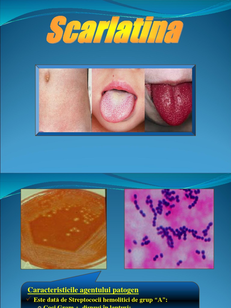 Scarlatina | PDF