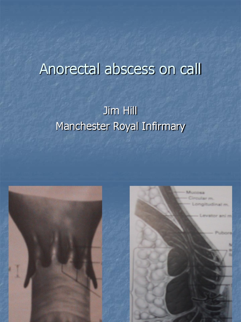 Anorectal Abscess On Call: Jim Hill Manchester Royal Infirmary | PDF ...