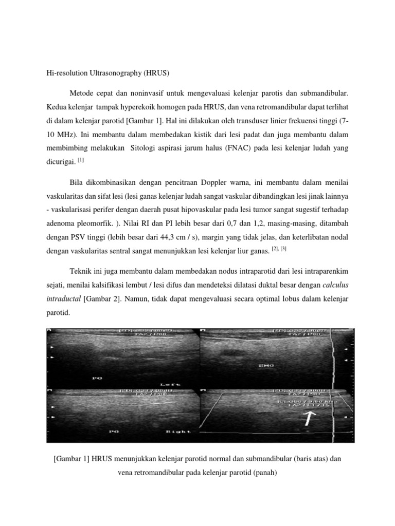 USG Massa Parotis | PDF