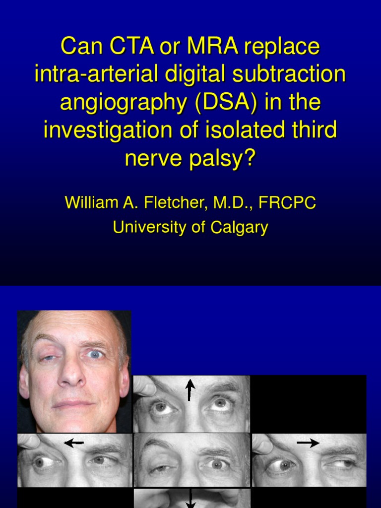 Can CTA or MRA Replace Intra-Arterial Digital Subtraction Angiography ...