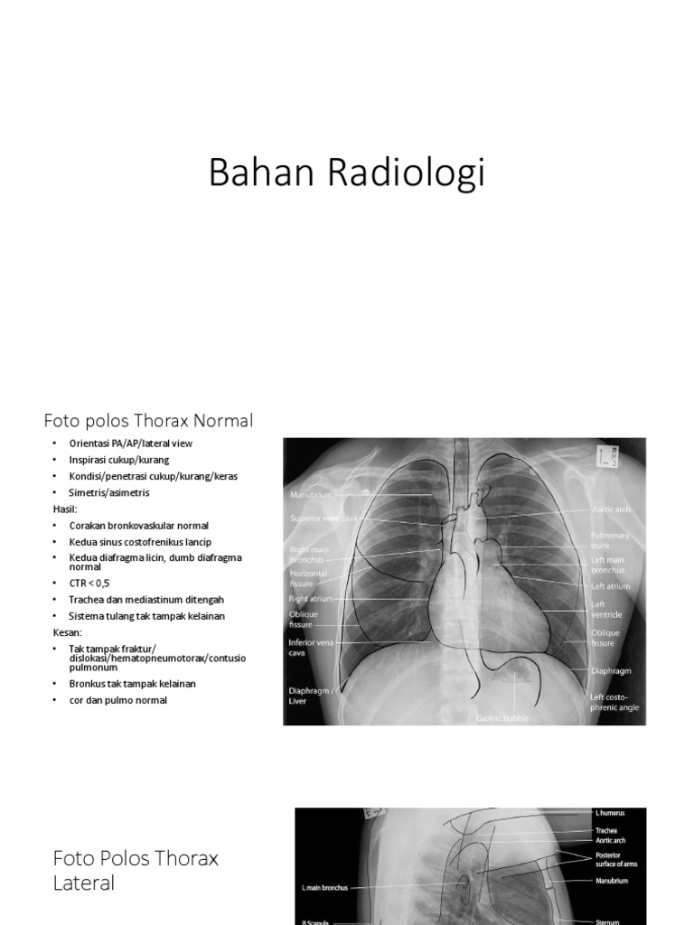 Bahan Radiologi | PDF