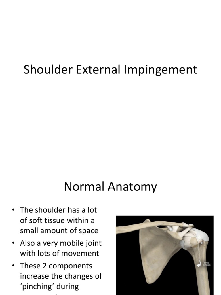 Shoulder External Impingement Handout | PDF | Shoulder ...