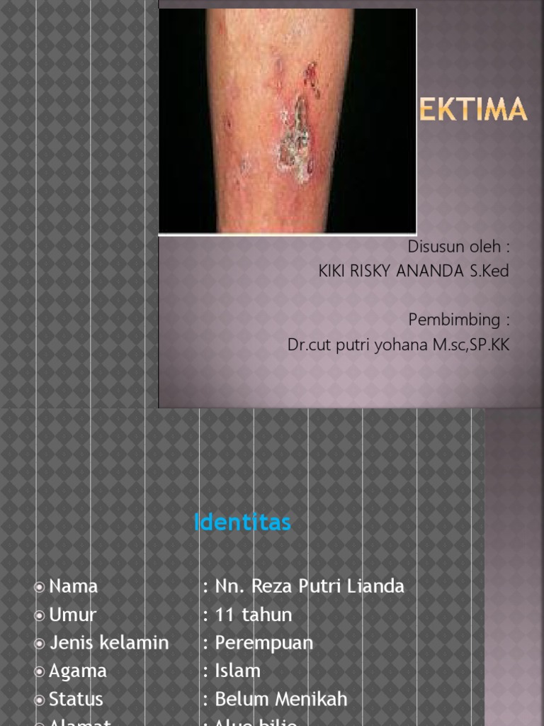 Ektima | PDF
