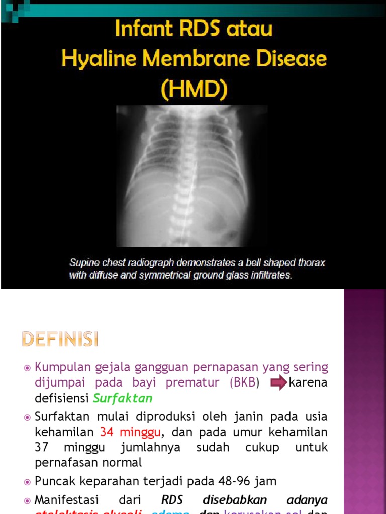 Hialin Membrane Disease | PDF