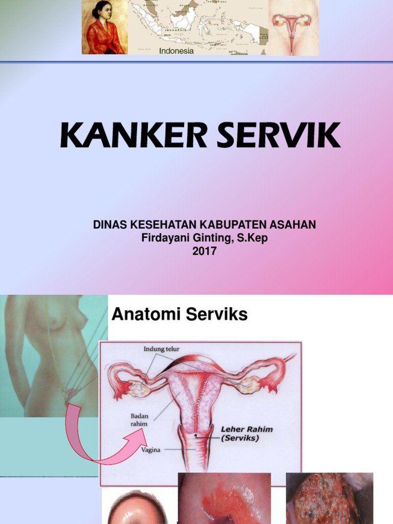 Deteksi Dini Kanker Serviks dan Pencegahan | PDF | Kesehatan Holistik