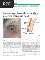ICD-10 Codes for Styes and Hordeola | PDF | Ophthalmology | Rtt