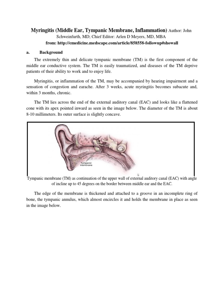 Journal Reading - Myringitis - Elisabeth Patty | PDF | Meningitis | Ear