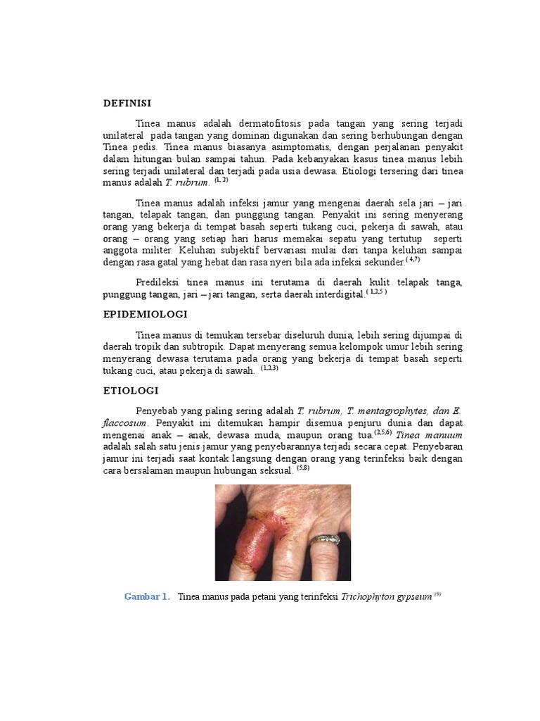 Tinea Manus | PDF