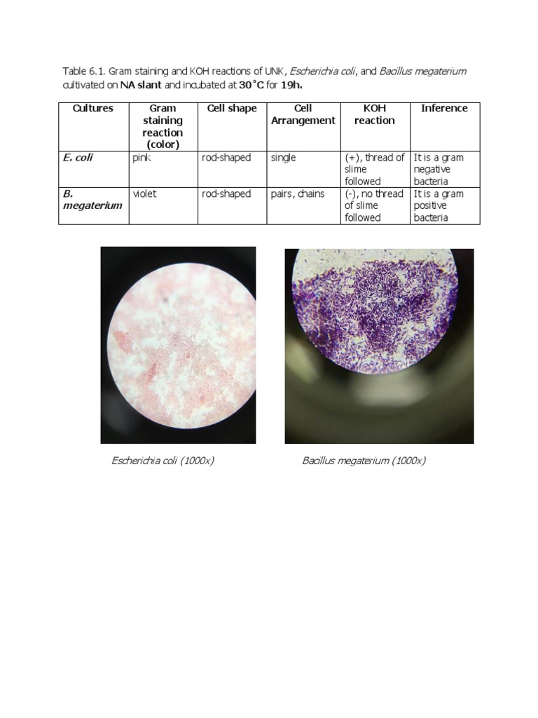 Escherichia Coli Bacillus Megaterium | PDF