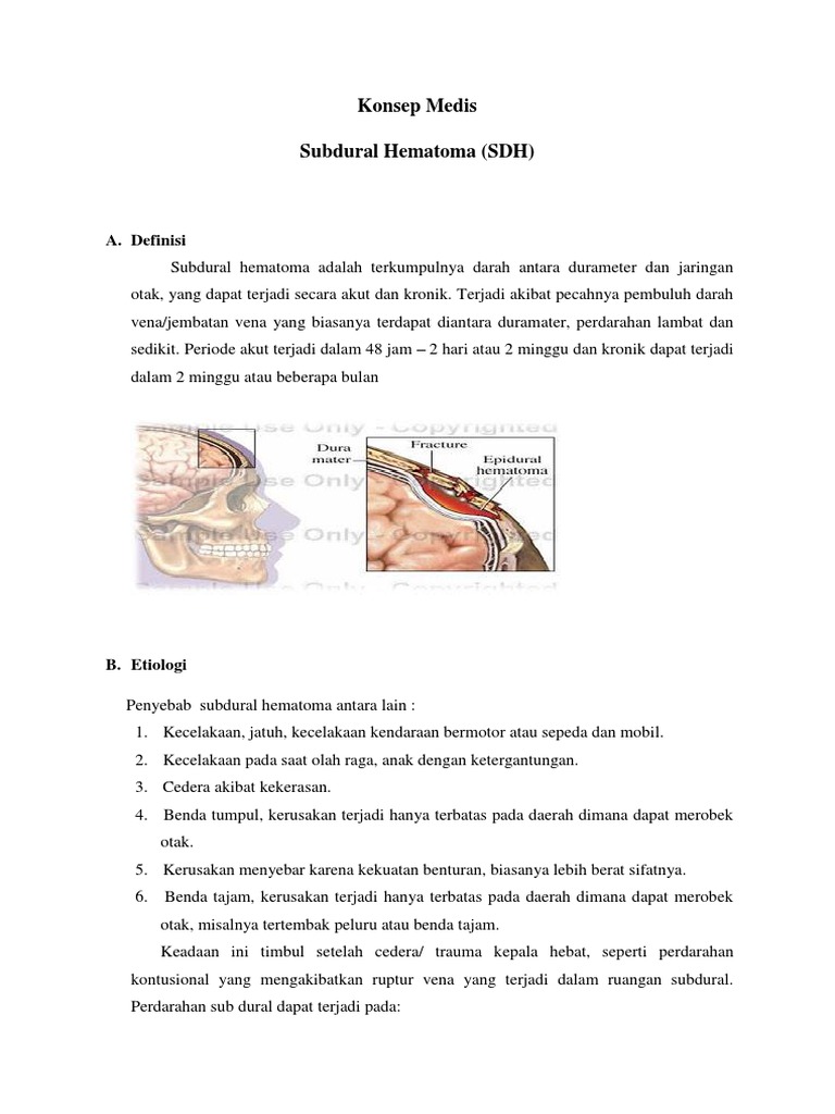 Askep SDH | PDF