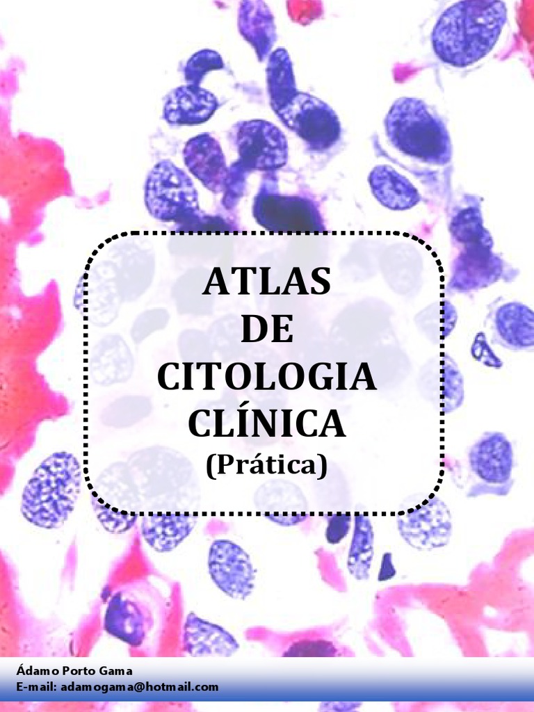 Atlas de Citologia Clínica Prática | PDF | Epitélio | Inflamação