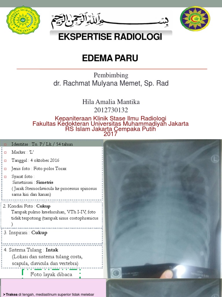 Edema Paru Radiologi | PDF | Sains & Matematika