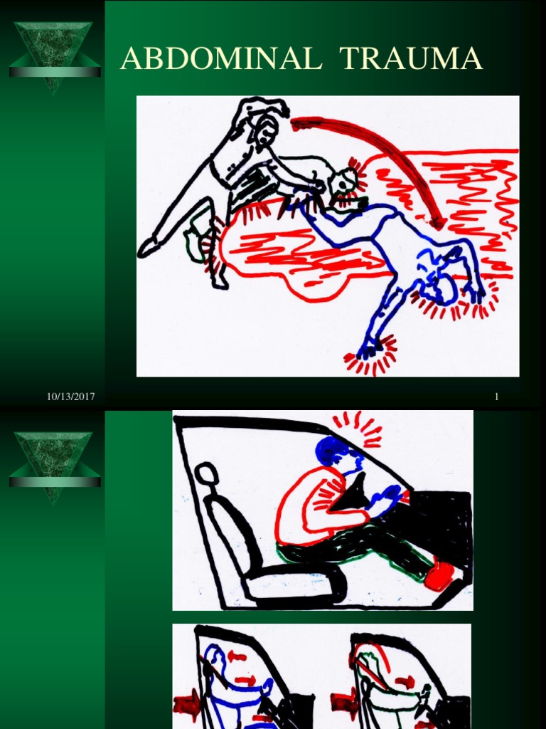 abdominal-trauma.ppt
