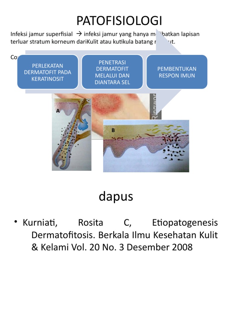 Patofis Superfisial Infection | PDF