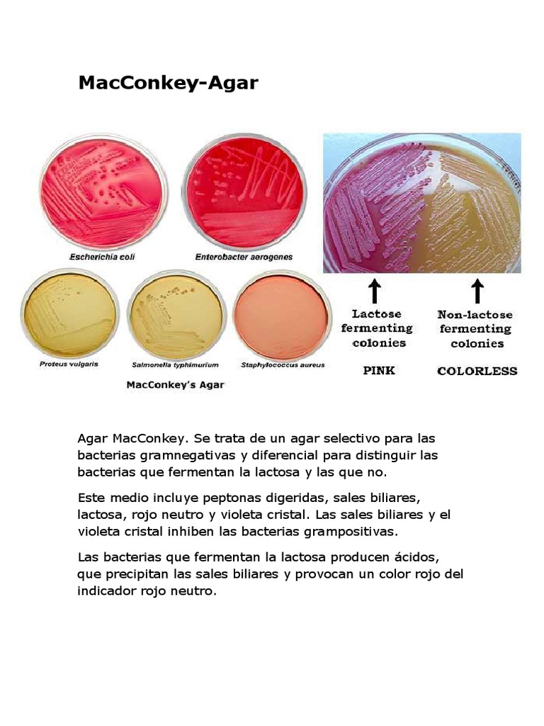 Agar MacConkey | PDF