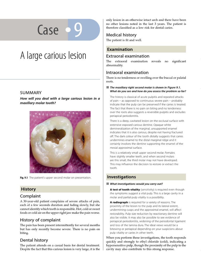 Managing Large Carious Lesions in Molars | PDF | Dentin | Tooth Enamel