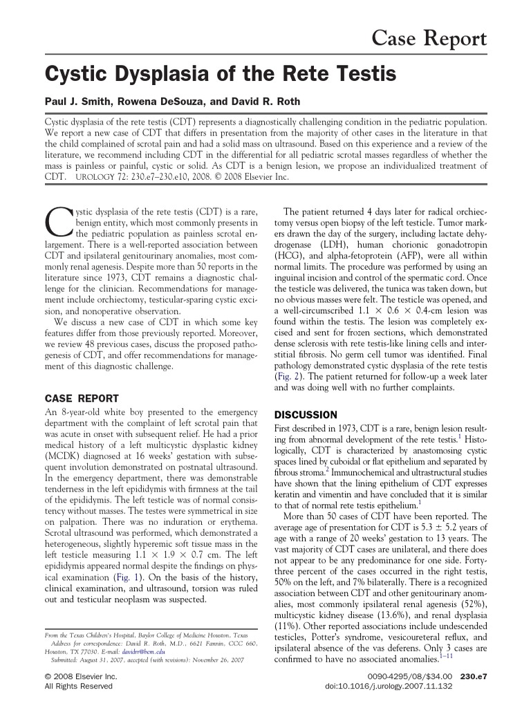 Cystic Dyplasia of Rete Testis | PDF | Neoplasms | Biopsy