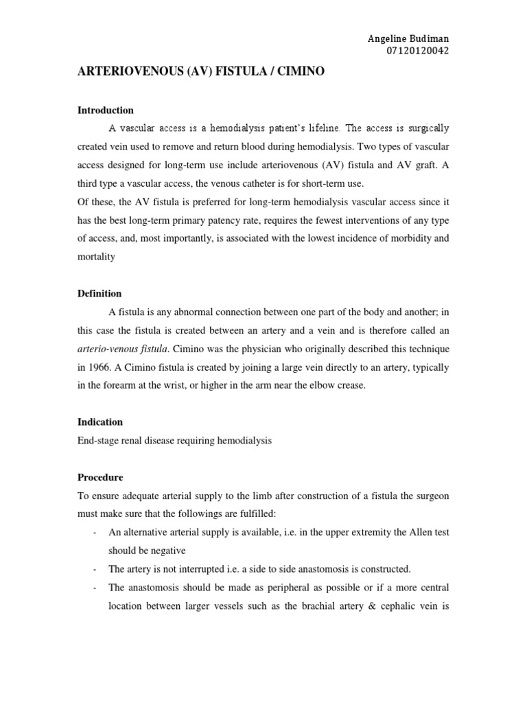 Cimino-Arteriovenous Shunt | PDF | Angiology | Medical Procedures