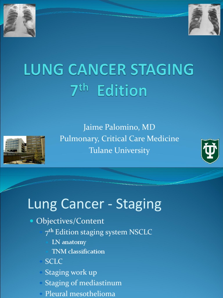 Lung Cancer Staging: 7th Edition Overview | PDF | Lung Cancer ...