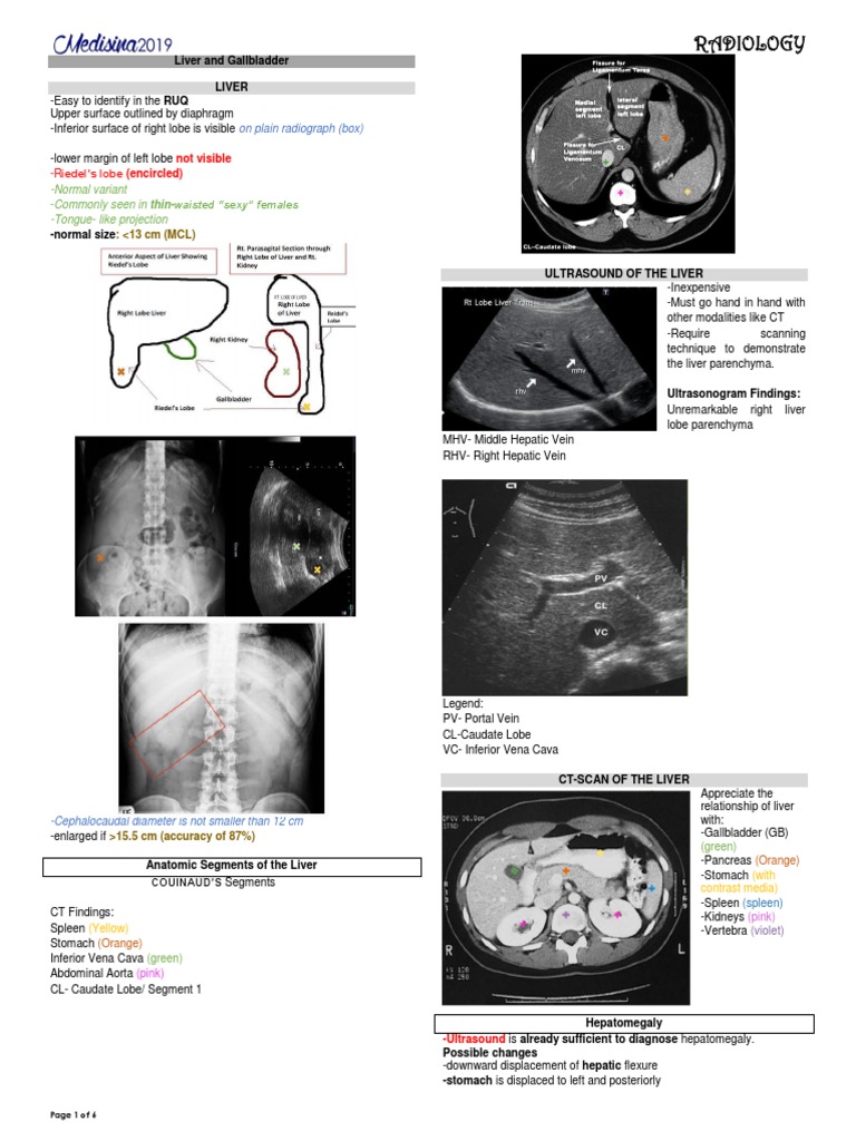 Riedel's Lobe and Gallbladder Ultrasound | PDF | Gallbladder | Liver