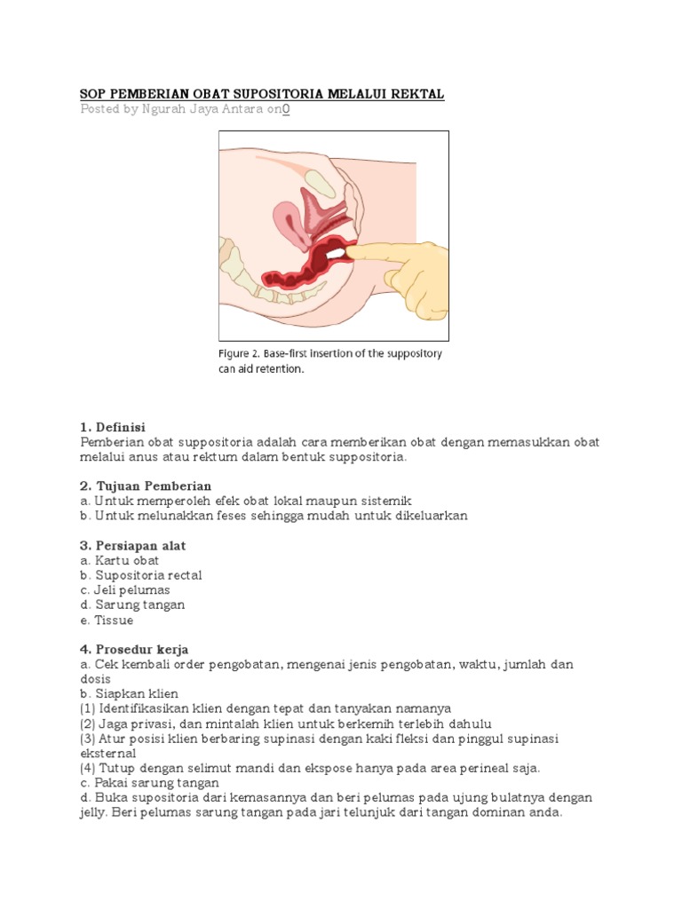 Sop Pemberian Obat Supositoria Melalui Rektal | PDF