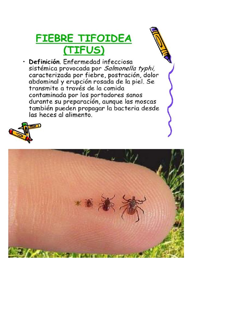 enfermedad tifus