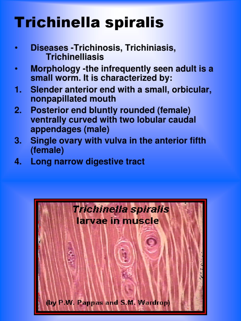 Trichuris and Trichinella | Parasites | Epidemiology