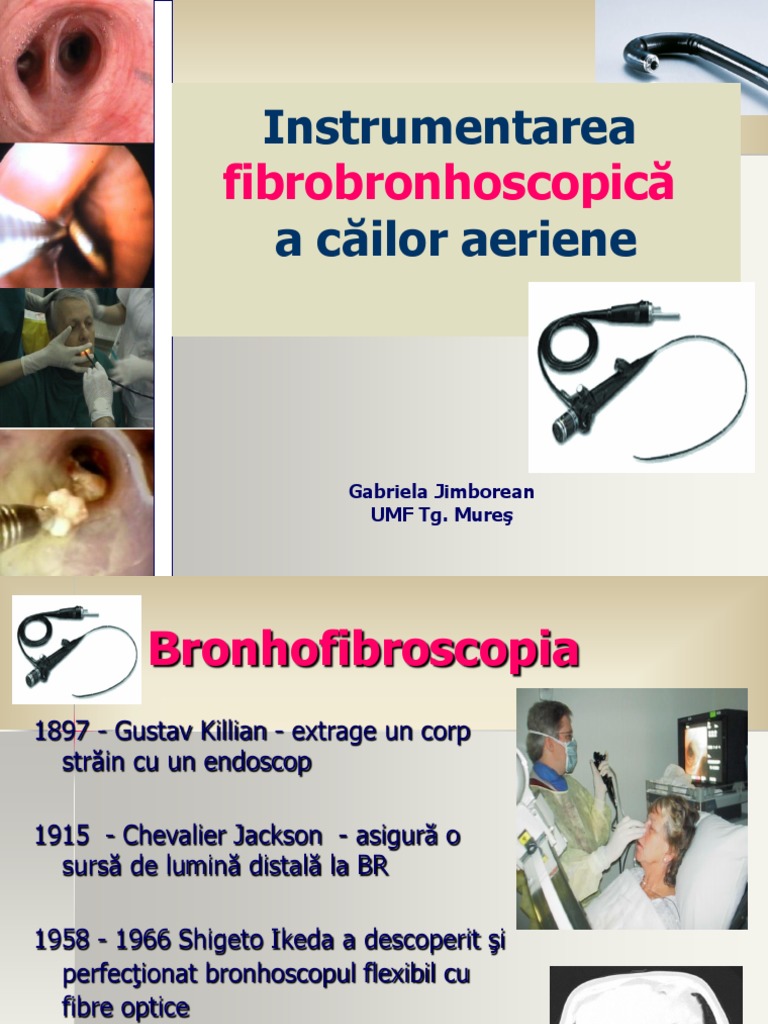 2016 Bronhoscopie | PDF