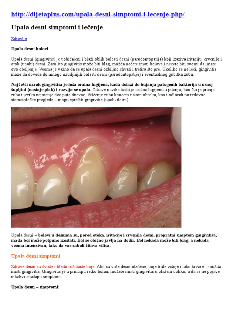 Upala Desni Simptomi I Lečenje | PDF