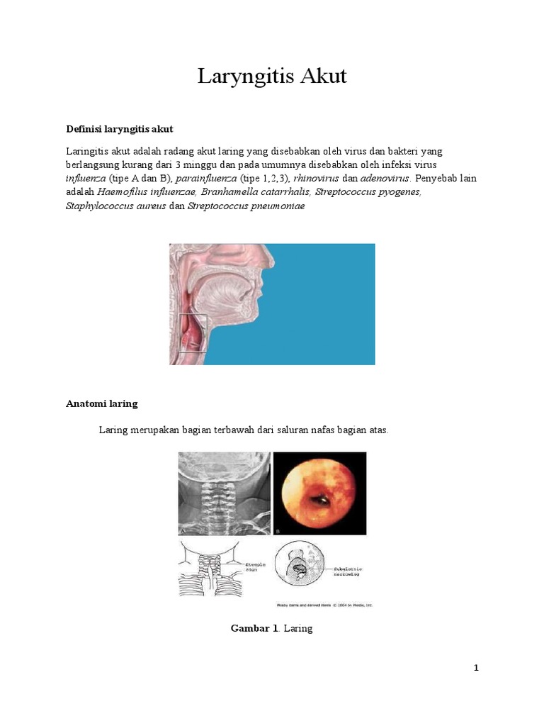 Laryngitis Akut | PDF