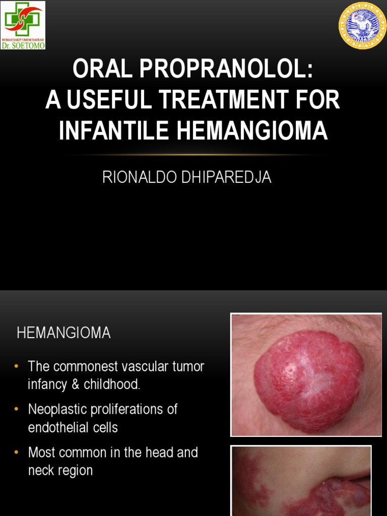 Oral Propranolol A Useful Treatment For Infantile Hemangioma Edit | PDF ...