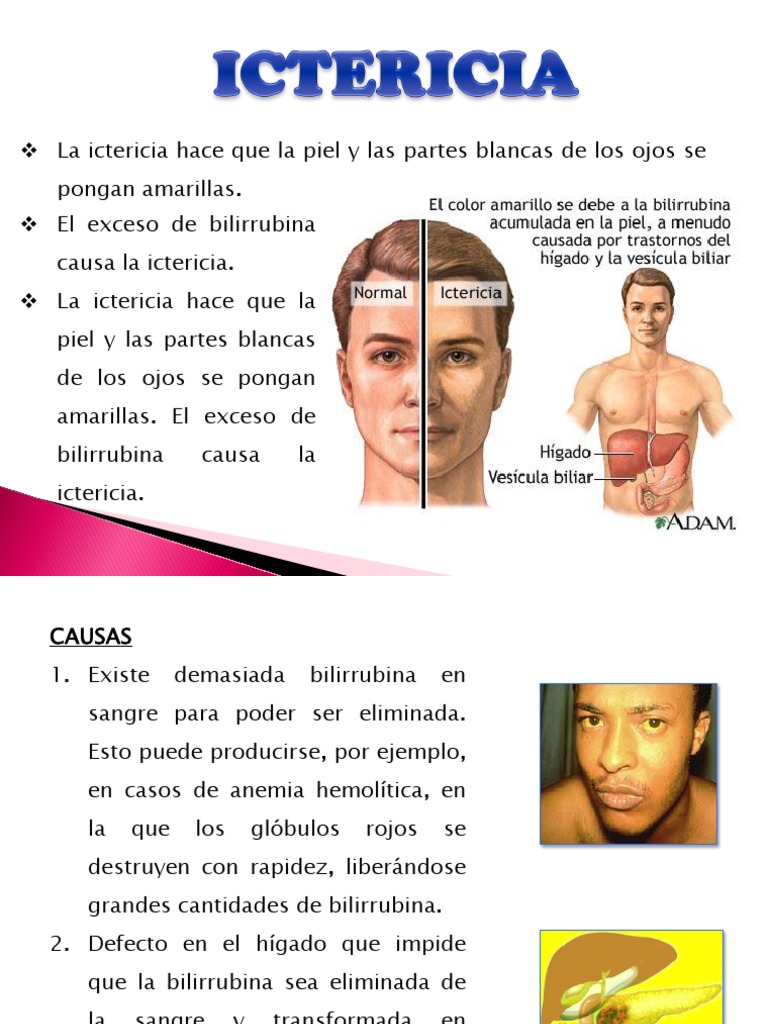 ICTERICIA | PDF | Especialidades Medicas | Enfermedades y trastornos
