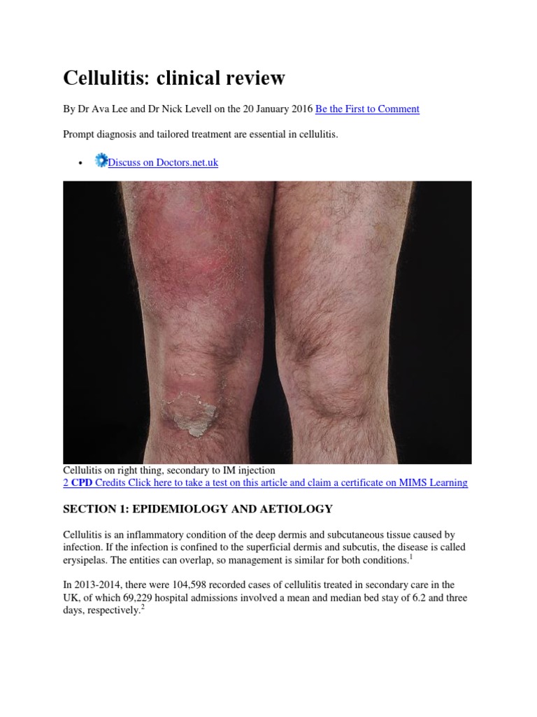 Cellulitis | PDF | Antibiotics | Varicose Veins