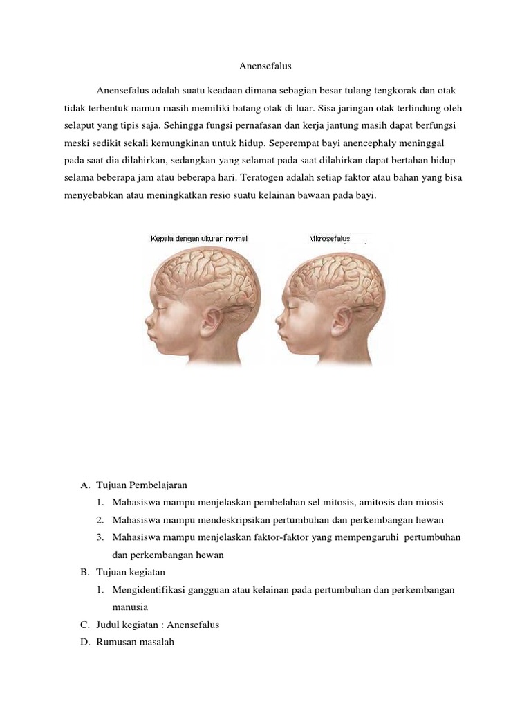 Anensefalus | PDF