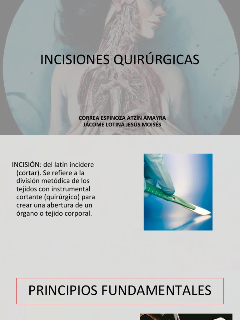 Incisiones Quirúrgicas 3 | PDF | Abdomen | Tórax