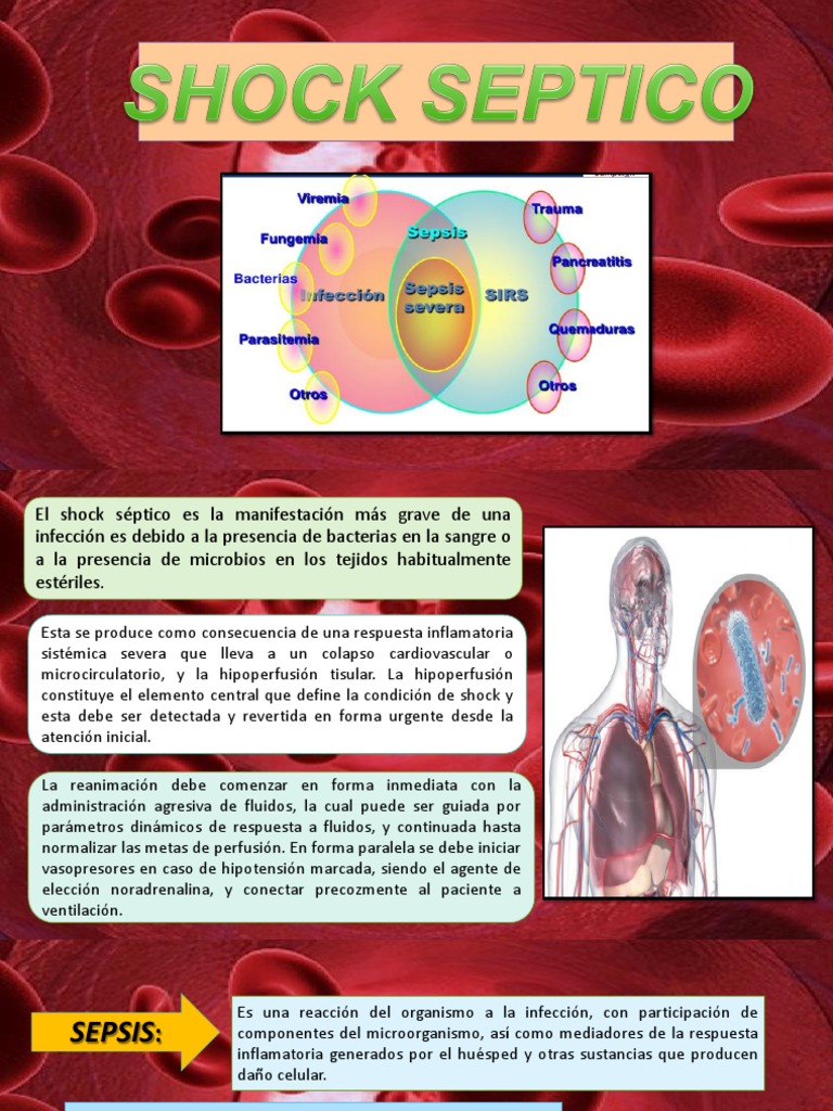 Shock Septico | PDF | Septicemia | Ciencias de la Salud